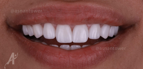 Asnan Tower - The best dental clinic & biggest dental center in Kuwait